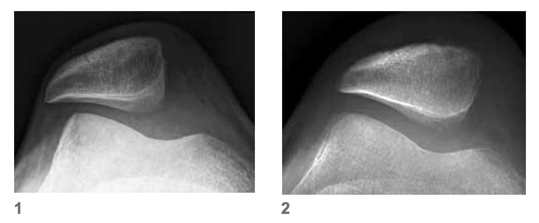 Patellaluxation – Leonardo